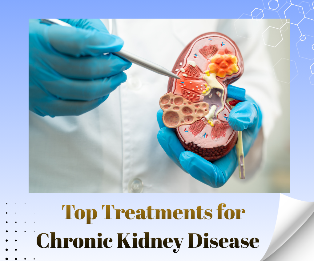 Effective Chronic Kidney Disease Treatment Options