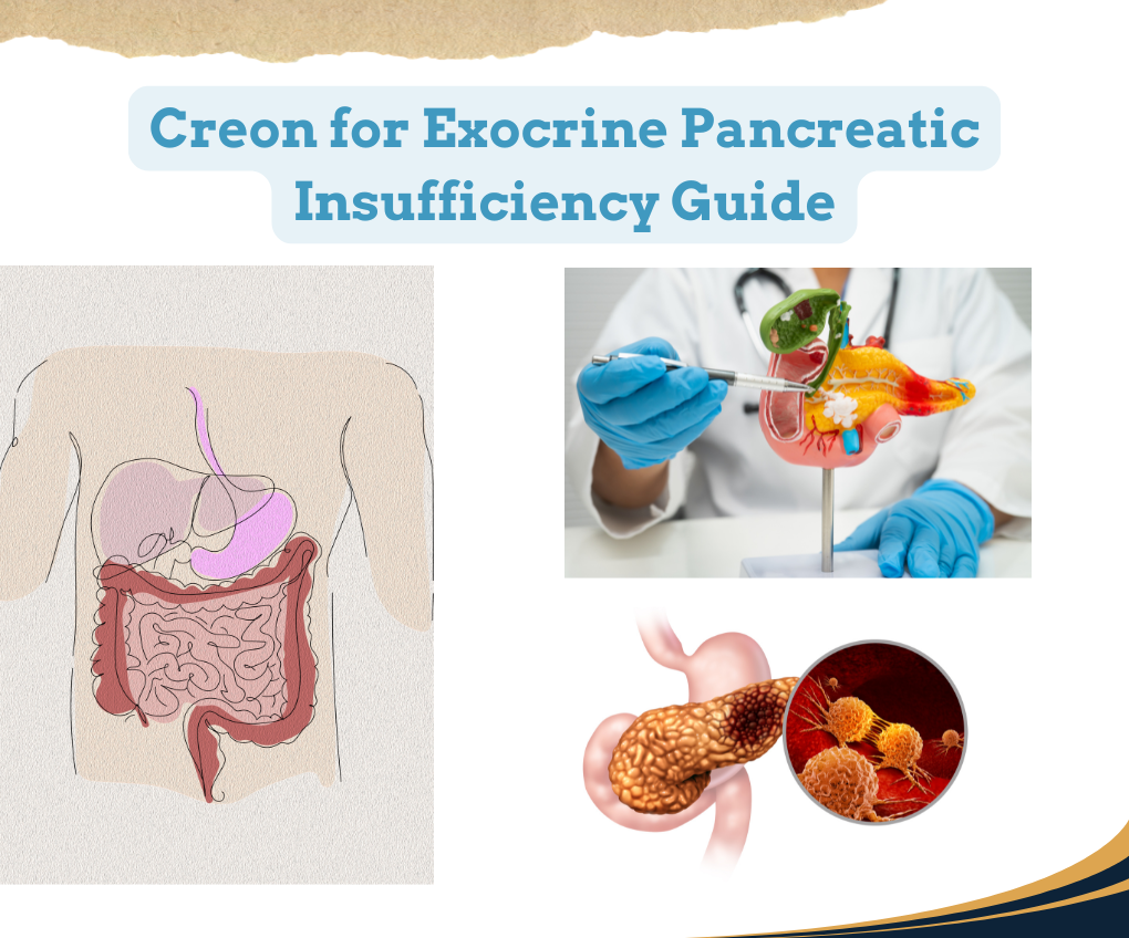 Creon for Exocrine Pancreatic Insufficiency Guide